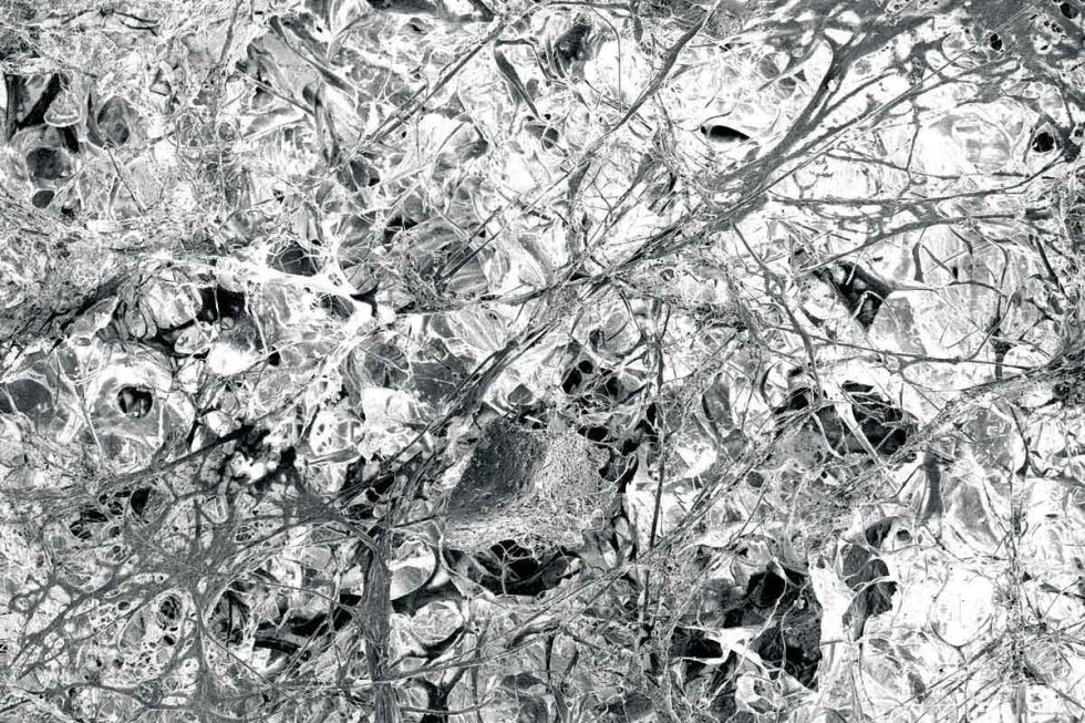 Botiss collacone max flexibilní kužel | Botiss | biomateriály